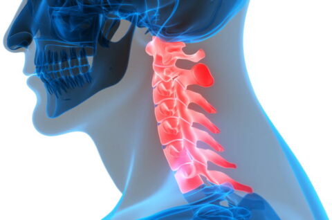 Halswirbelsäule / HWS-Syndrom - ERGOFIT | macht den Rücken fit